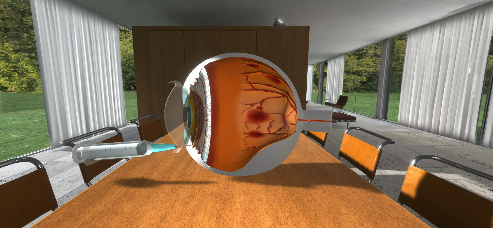 Retinal Vein Occlusion Animations & Simulation Tools | Vision RELIEF